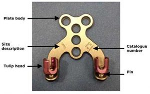 Stryker Spine Plate Recall - Malcomson Law Solicitors LLP